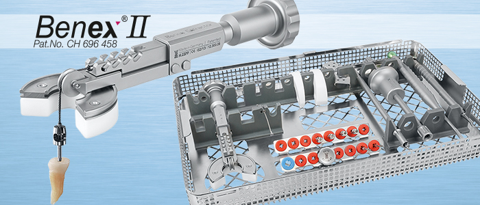 benex extractor 12.302.00 BENEX II Extraktions-System komplett, nach Dr ...